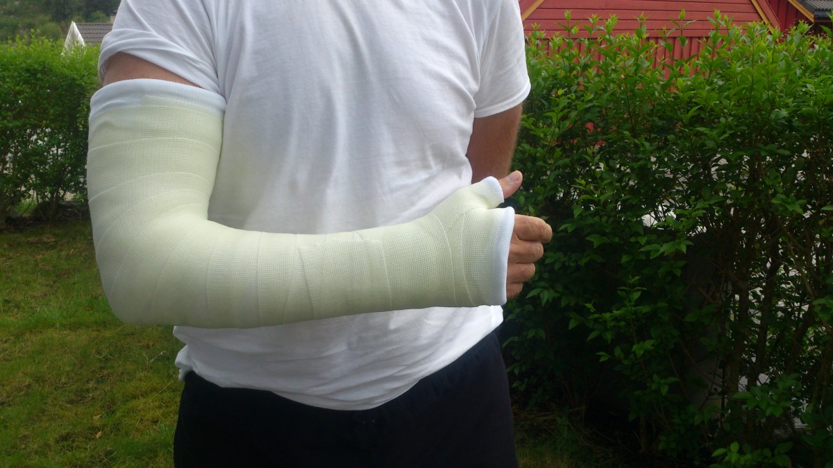 4 nye uker i gips